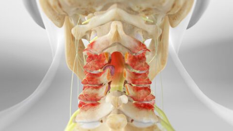 Neurosurgery - SpineMed Specialists